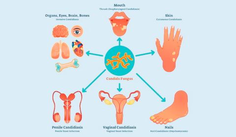 Cos'è la Candida albicans e come trattarla