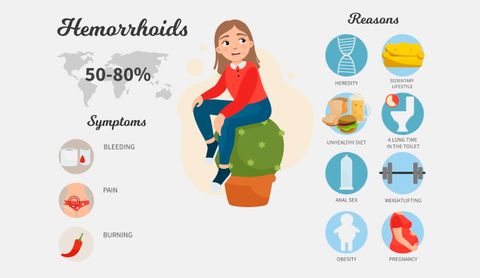 Emorroidi: cosa sono, come trattarle ed evitarle