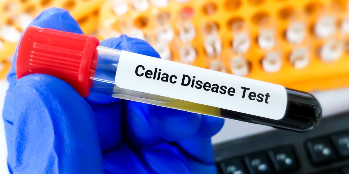Test per la celiachia: cosa sono e come funzionano