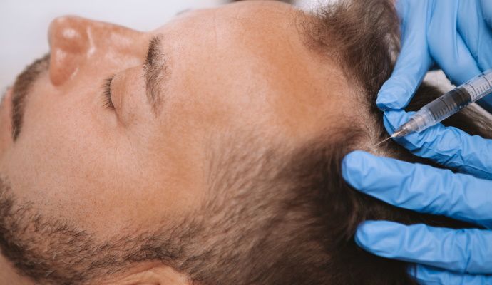 Calvizie uomo: cos'è, cause e rimedi utili