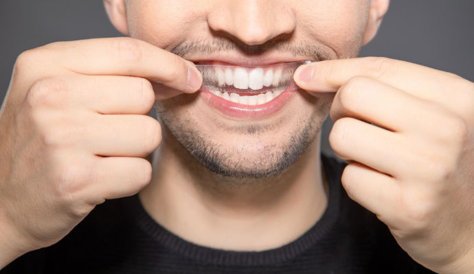 Strisce sbiancanti per i denti: come si utilizzano?